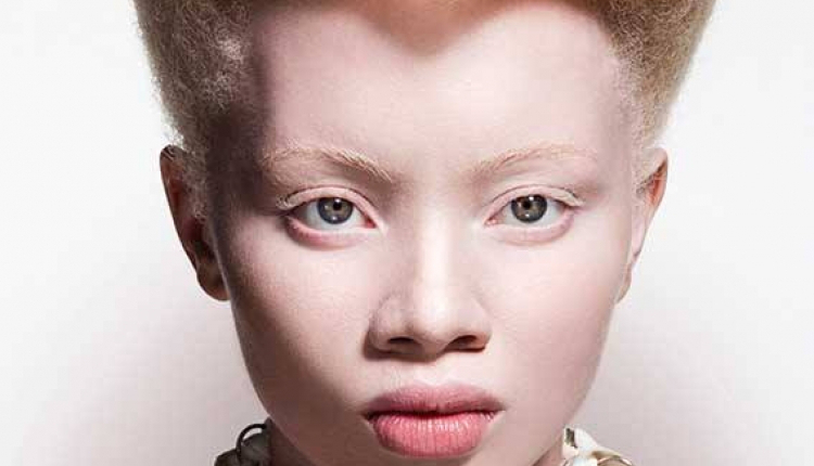 feature: thando hopa – a model and activist fighting for the rights of ...