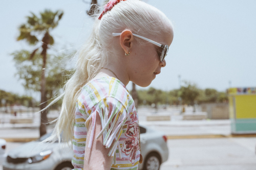 FEATURE: ‘Clear As Black’ – a photo essay on albinism in Puerto Rico by ...
